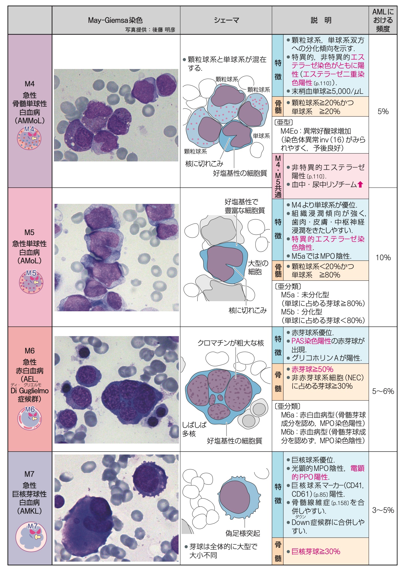 AML（急性骨髄性白血病），ALL（急性リンパ性白血病）のFAB分類 ｜臨床検査技師になろう！｜国家試験対策に役立つ情報をお届け